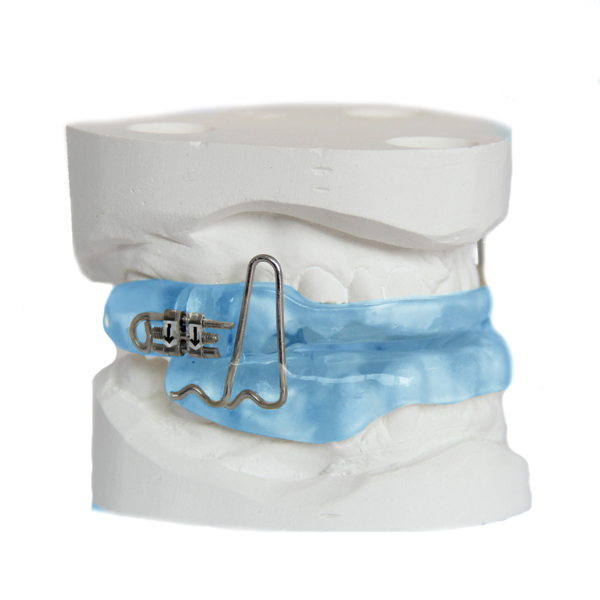 Wat is een MRA beugel? - SomnoClinic - Kliniek voor snurken en apneu